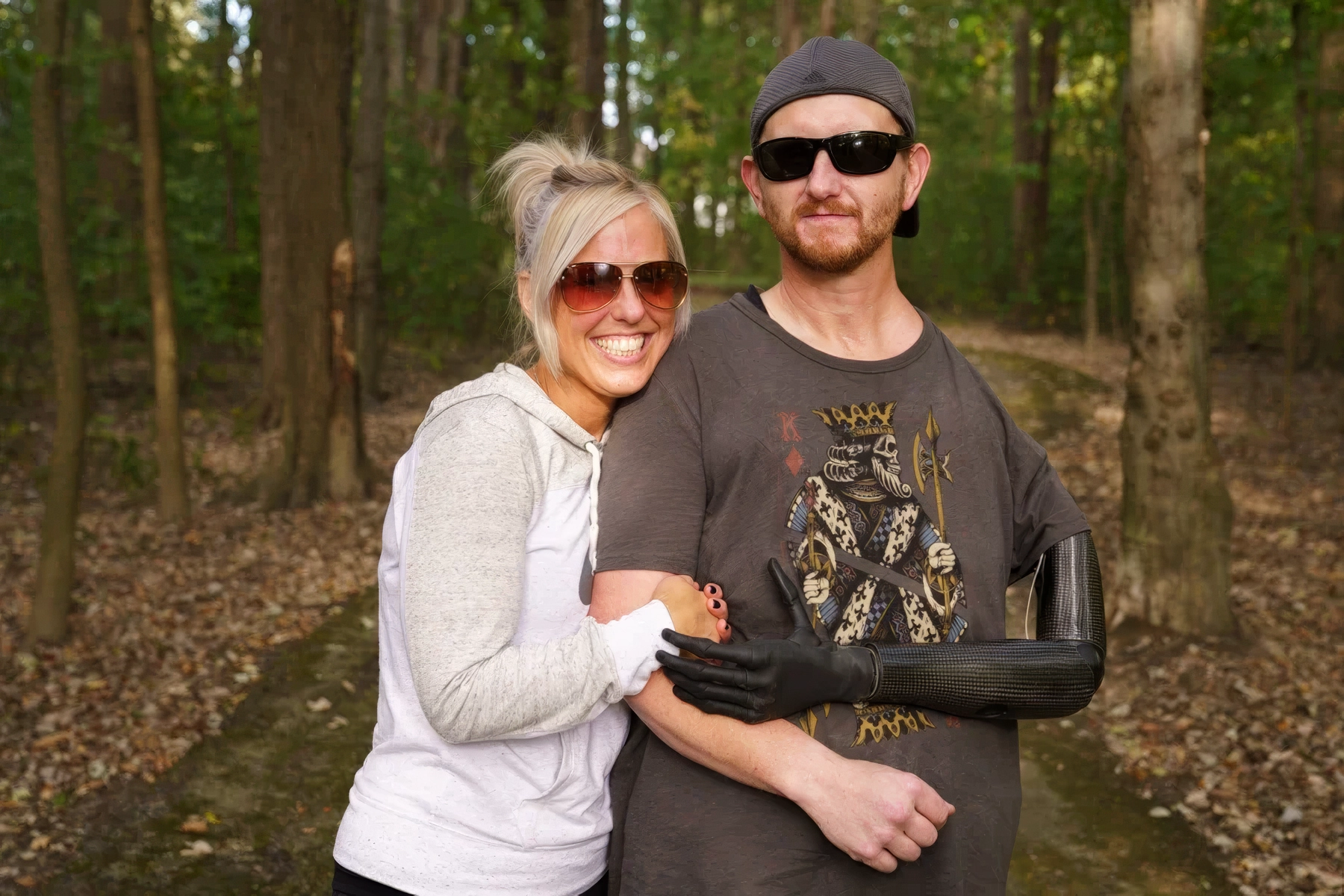 Shoulder Level Limb Differences